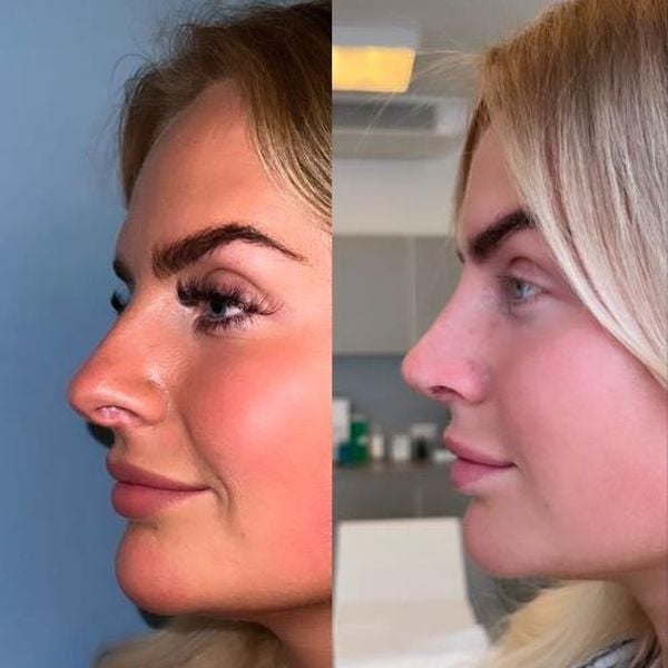 Anna Iffländer | Promiflash