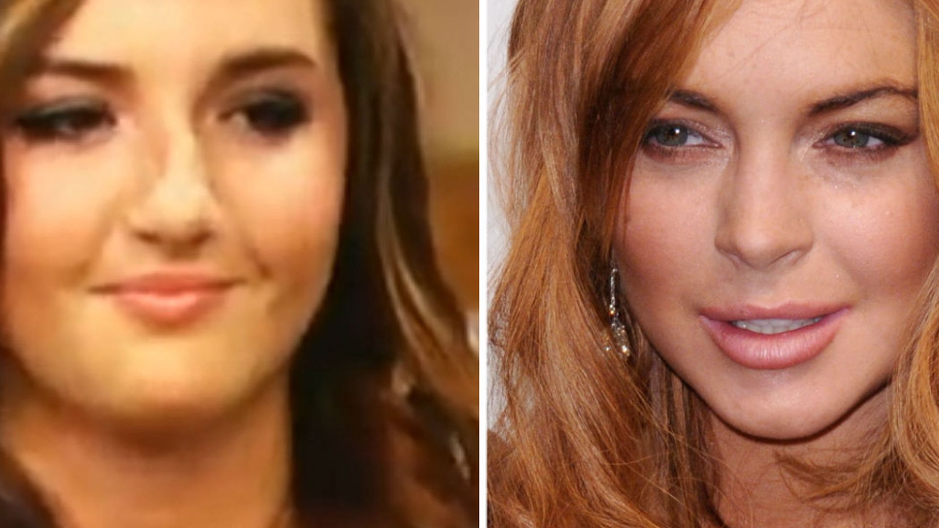 Lindsay Lohans Halbschwester doch nicht operiert | Promiflash.de