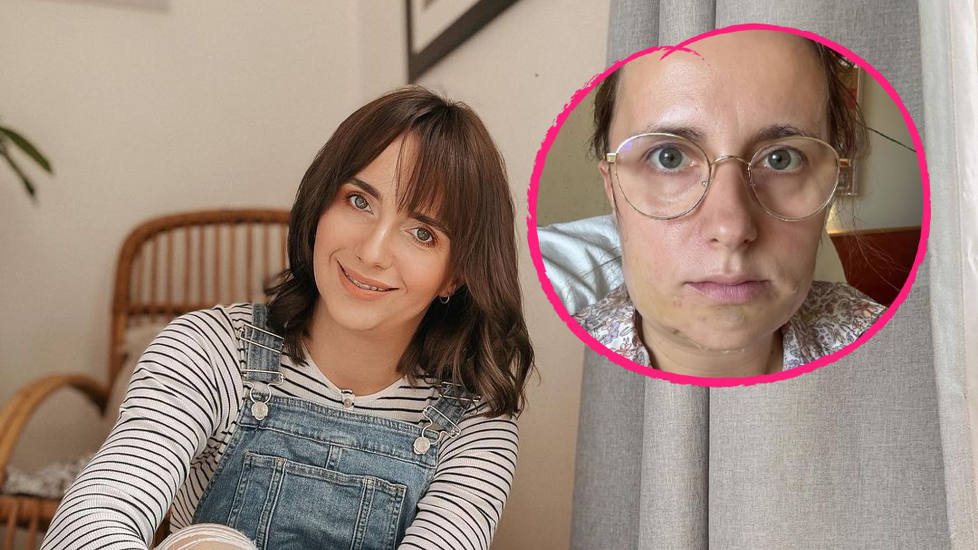 Anna Heiser zeigt ihre krasse Unterkiefer-Transformation!