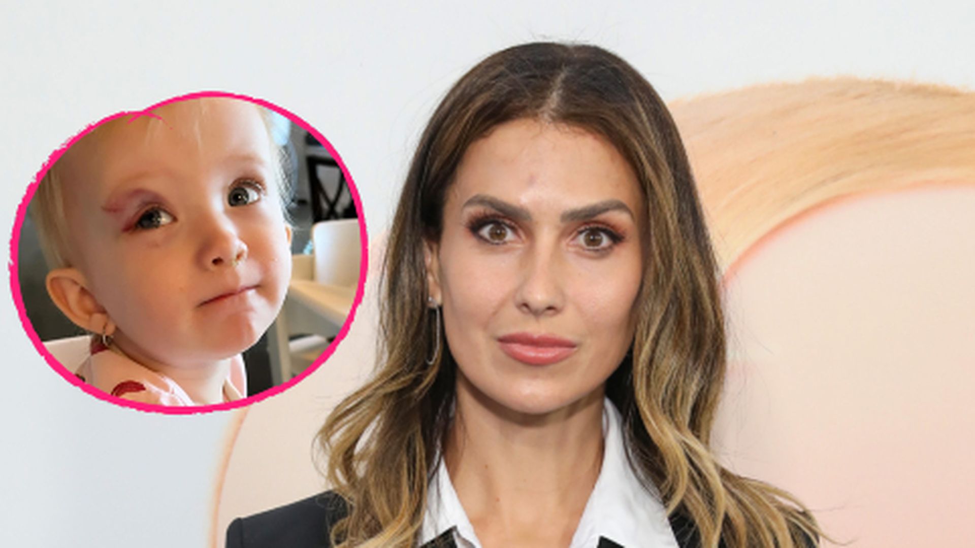 Autsch! Hilaria Baldwins Tochter (1) hat ein blaues Auge