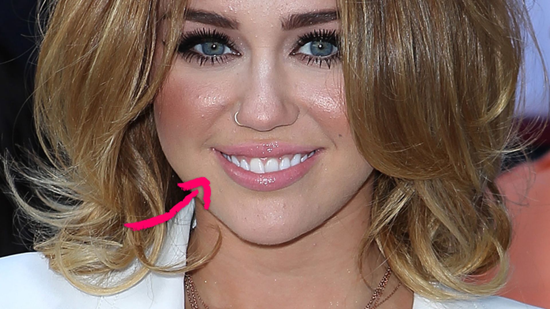 Miley Cyrus: 19 Jahre und schon im Botox-Wahn? | Promiflash.de