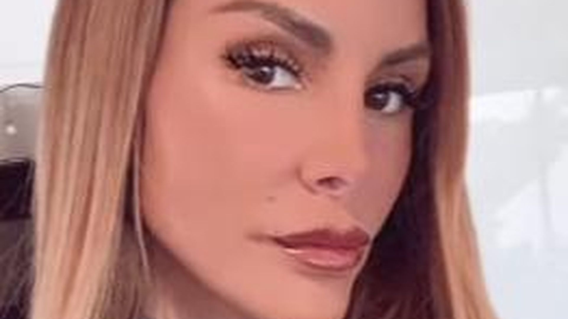 Filler aufgelöst: Lisha Savage zeigt ihr "echtes Gesicht"