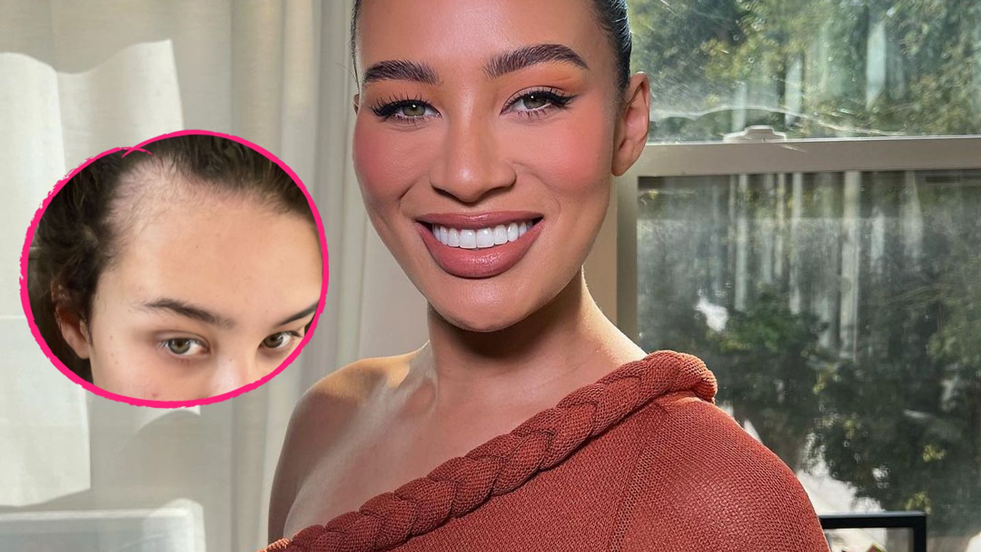 Montana Brown kämpft nach Geburt ihres Babys mit Haarausfall