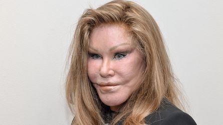 Jocelyn Wildenstein hinterlässt Partner 93 Millionen Euro