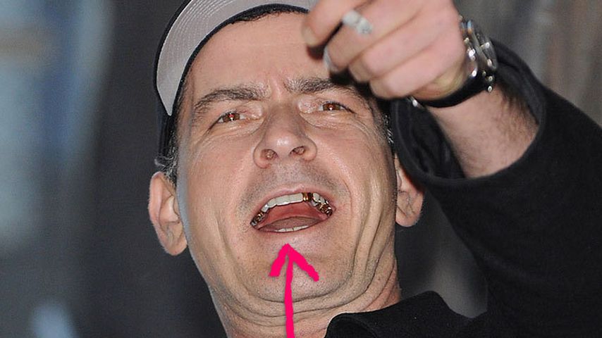 Charlie Sheen beim Promiflash-Zahnarzt | Promiflash.de