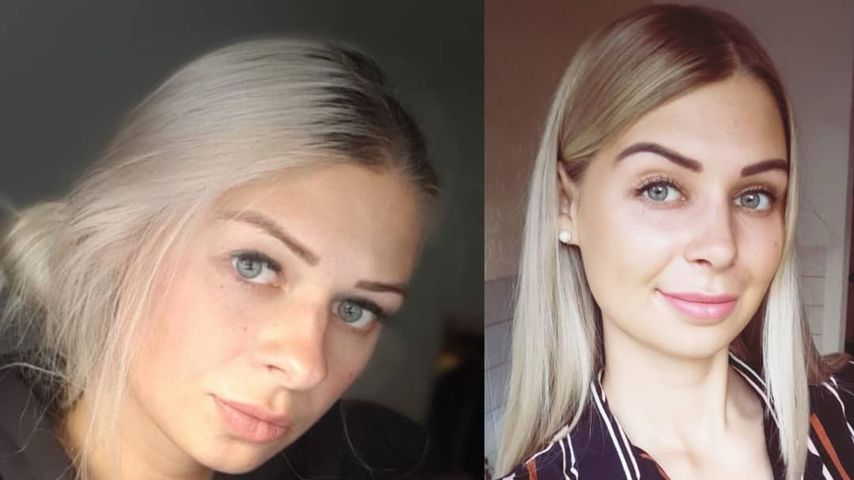 Happy nach Beauty-OP: "Love Island"-Lisa hat neues Näschen! | Promiflash.de