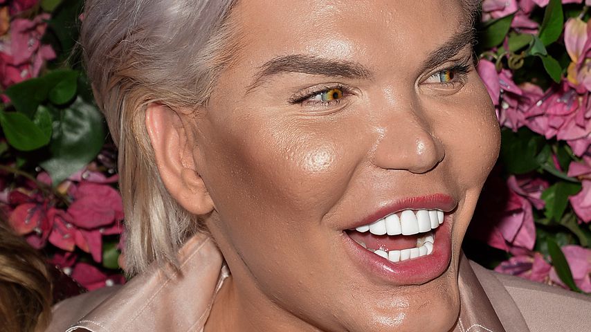 "Plastic World": OP-Junkie Rodrigo Alves singt jetzt auch! | Promiflash.de